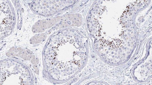 Testes 'most distinct human tissue' - BBC News