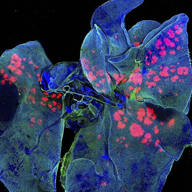 The art of science - Wellcome Images 2015 - BBC News