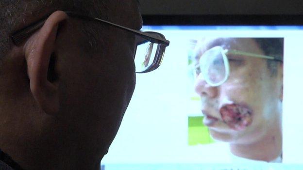 Asia's deadly secret: The scourge of the betel nut - BBC News