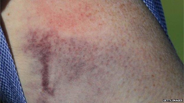 What happens at a slapping workshop? - BBC News