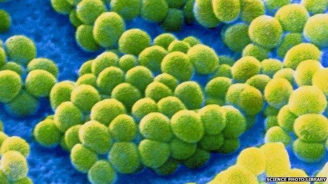 Thousands of microbes found in house dust - BBC News