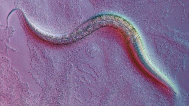 Sound waves used to activate brain cells in a worm - BBC News