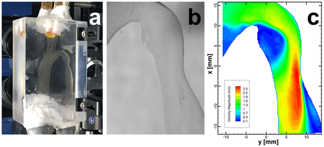 Supercomputer simulates whole-body blood flow - BBC News