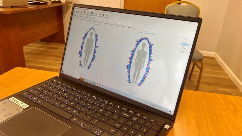 The truth about 'medbeds' - a miracle cure that doesn't exist - BBC News