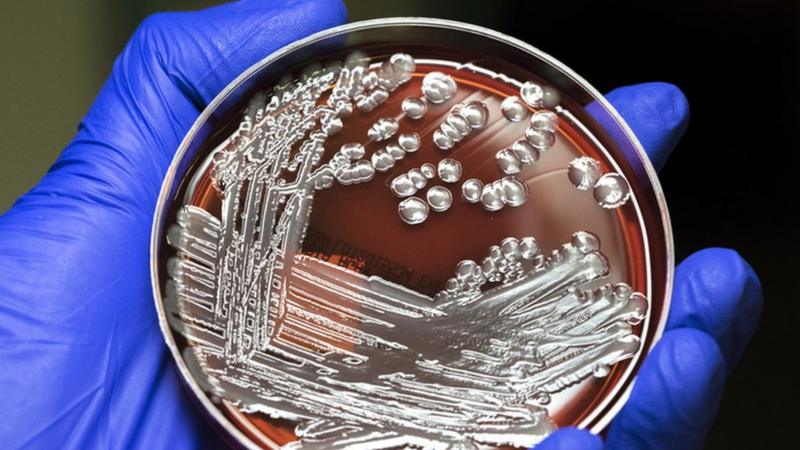 Superbugs: Antibiotic-resistant infection left me with hip of a 70-year ...