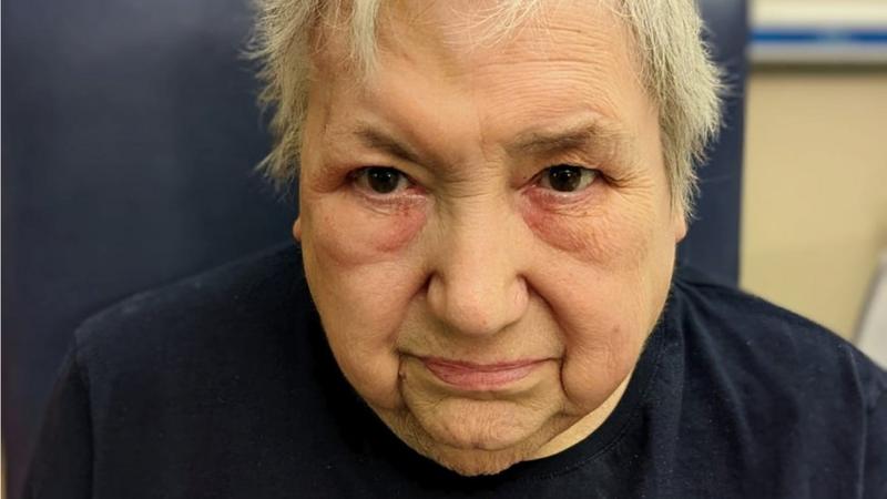 NHS discharges: Reasons for hospital departure delays revealed - BBC News