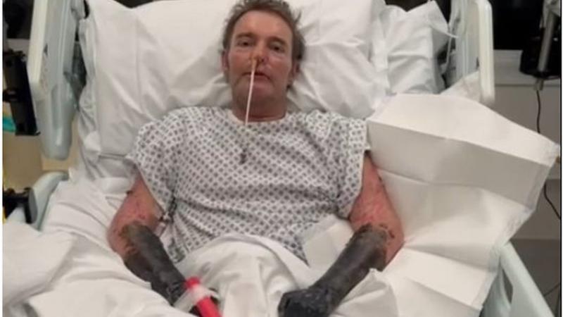 My limbs were amputated after sepsis, says MP Craig Mackinlay - BBC News