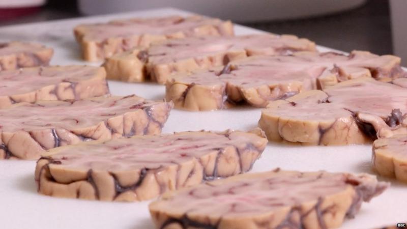 Banking Britain's brains: The story of a scientific resource - BBC News