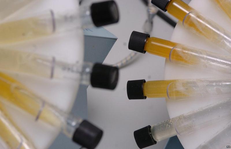 What does 'doping' mean in athletics and why do athletes take banned ...