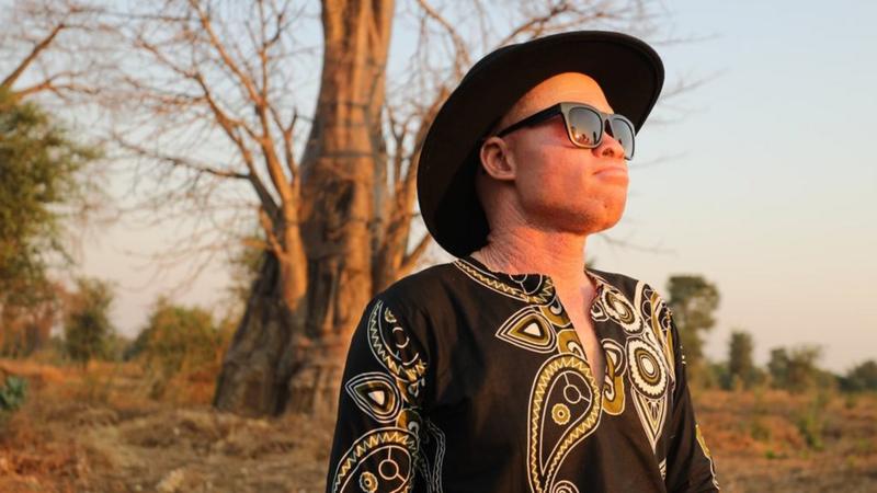 Somalis with albinism: Pelted with stones and raw eggs - BBC News