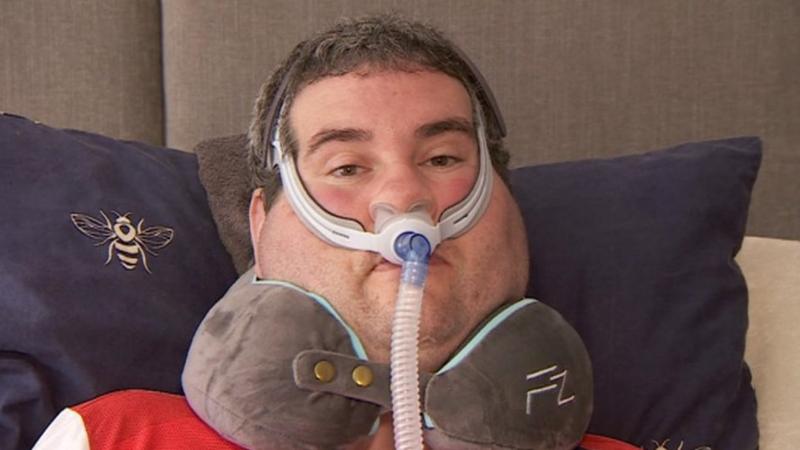 Motor neurone disease: Sufferers describe wait to get diagnosed - BBC News