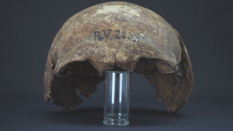 First scientific evidence of Black Death in Edinburgh found on skeleton ...