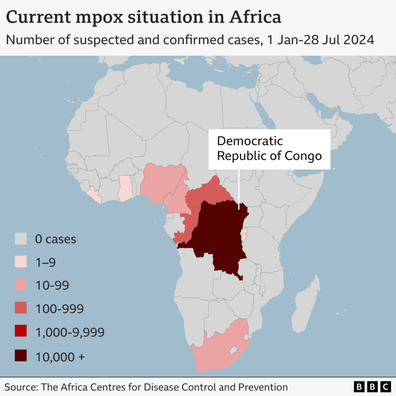 What is mpox, what are the symptoms and which countries is it in? - BBC ...