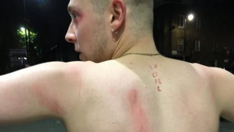 Wargasm singer's head 'held down backstage toilet by bouncers' - BBC News