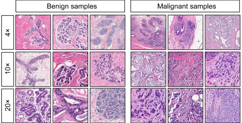 Pigeons identify breast cancer 'as well as humans' - BBC News