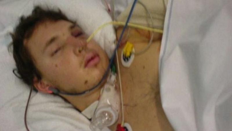 What is it like to survive a hit-and-run? - BBC News