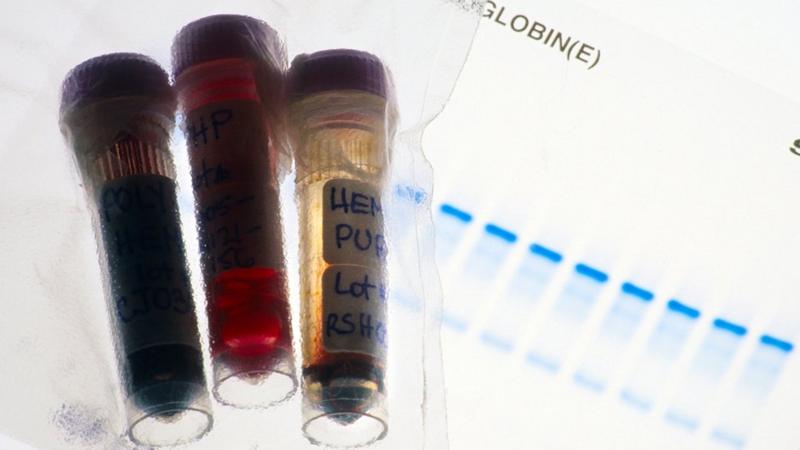 Russia state-sponsored doping across majority of Olympic sports, claims ...