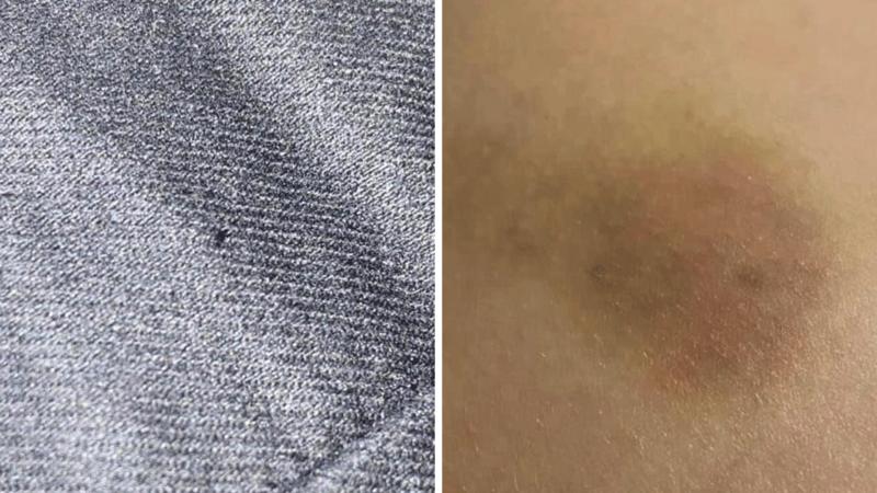 Ipswich: Spiking by needle victim too scared to go out - BBC News