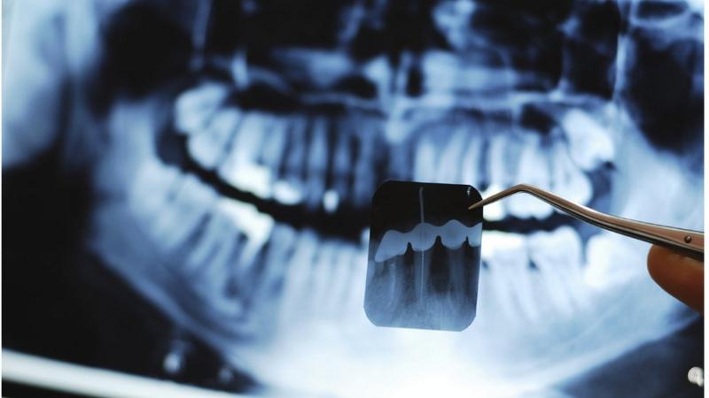 Can you catch a killer using only teeth marks? - BBC News