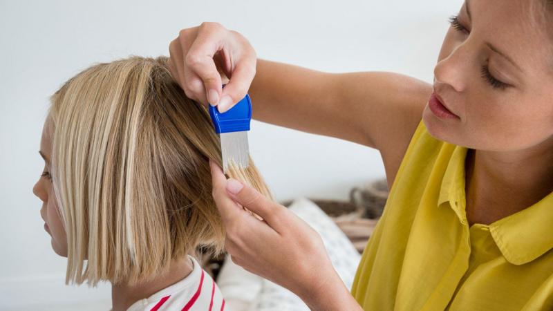 Head lice and nits: Treatment and myths and truths - BBC Newsround