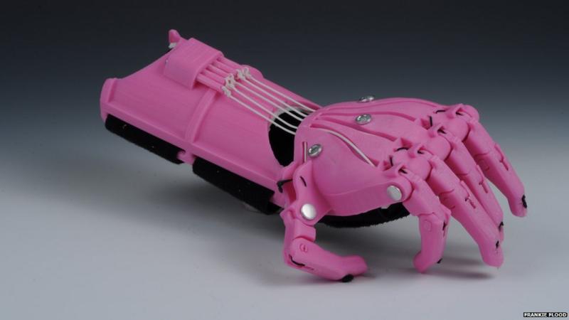 Handy work: The making of Hayley Fraser's new hand - BBC News