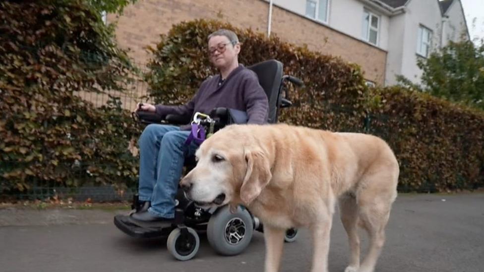 Goldenhar Syndrome: 'Perfect' baby born with extremely rare condition ...