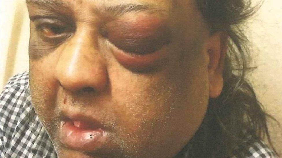 Vulnerable man badly beaten by muggers in Gloucester - BBC News