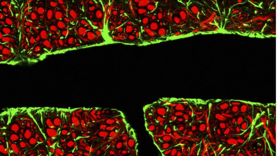 Scientists breach brain barrier to treat sick patient - BBC News