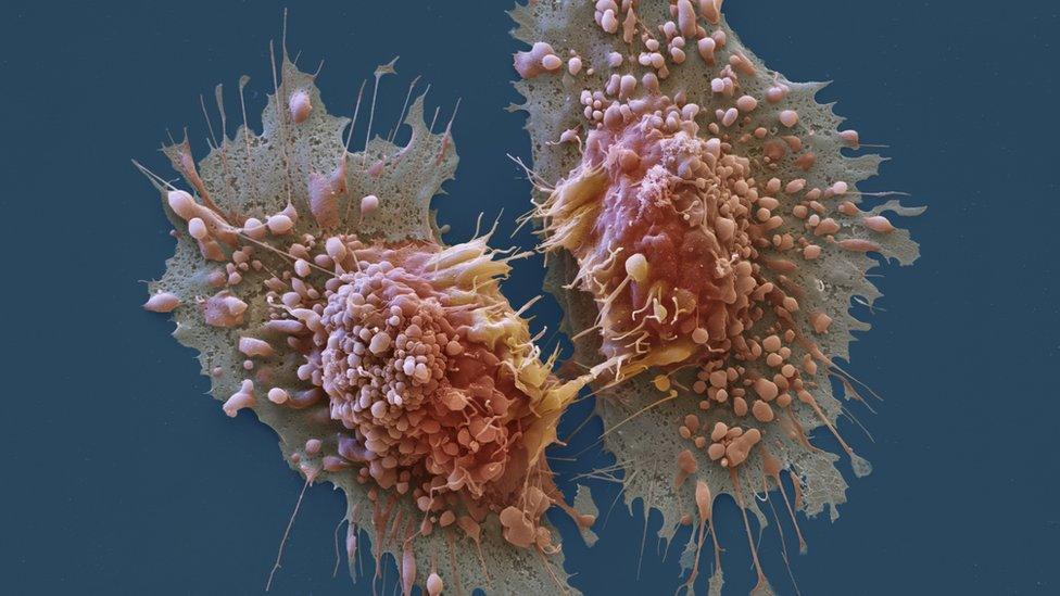 New test measures cancer drugs success - BBC News