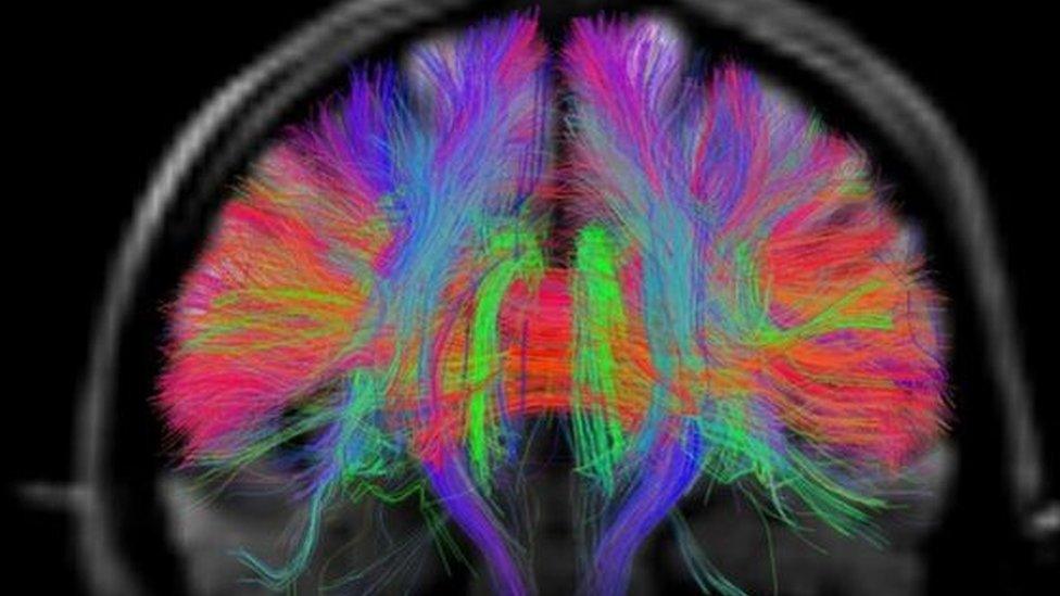 Chemicals 'repair damaged neurons in mice' - BBC News