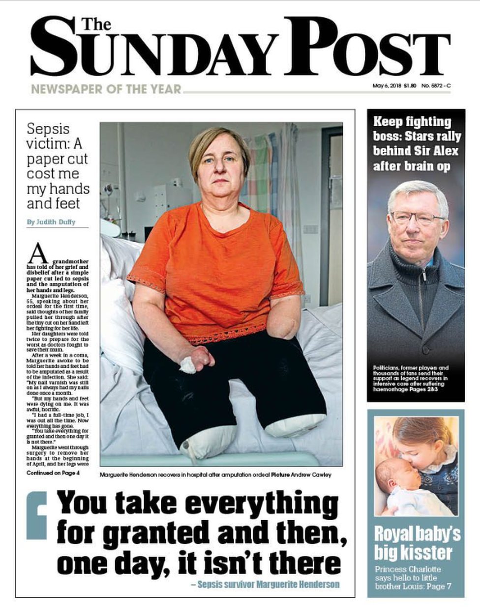 The papers: Fergie 'fights for life' after brain operation - BBC News