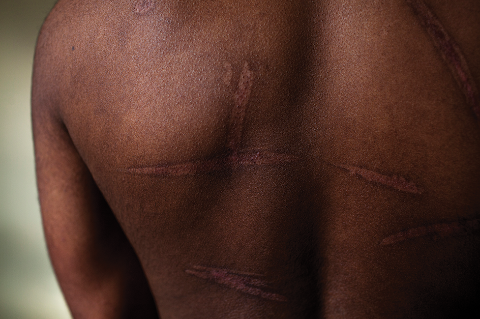 Torture evidence ignored by Home Office, says charity - BBC News