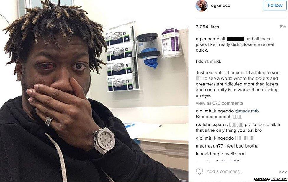 Rapper reveals eye loss on Instagram after car crash - BBC News