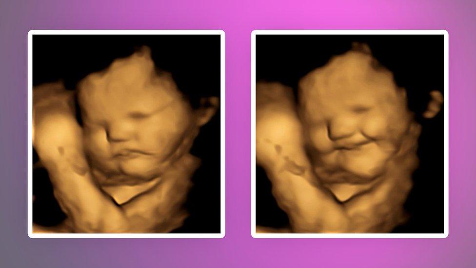 Babies pull funny faces when pregnant mums eat kale, study shows - BBC ...