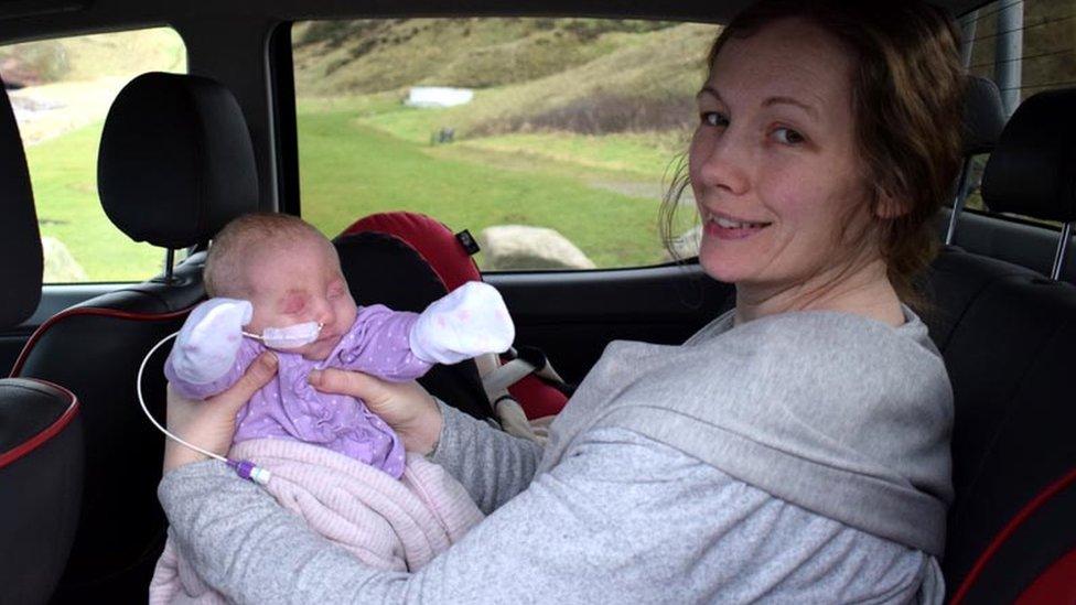 Parents of ill Edwards Syndrome baby seek medical records - BBC News