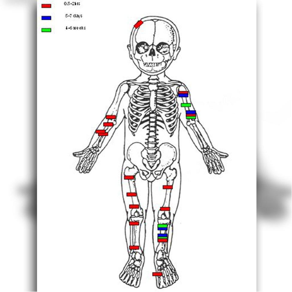 Noah Serra-Morrison murder accused Hardeep Hunjan guilty - BBC News