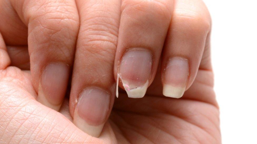 A&E 'broken fingernail' visit warning - BBC News