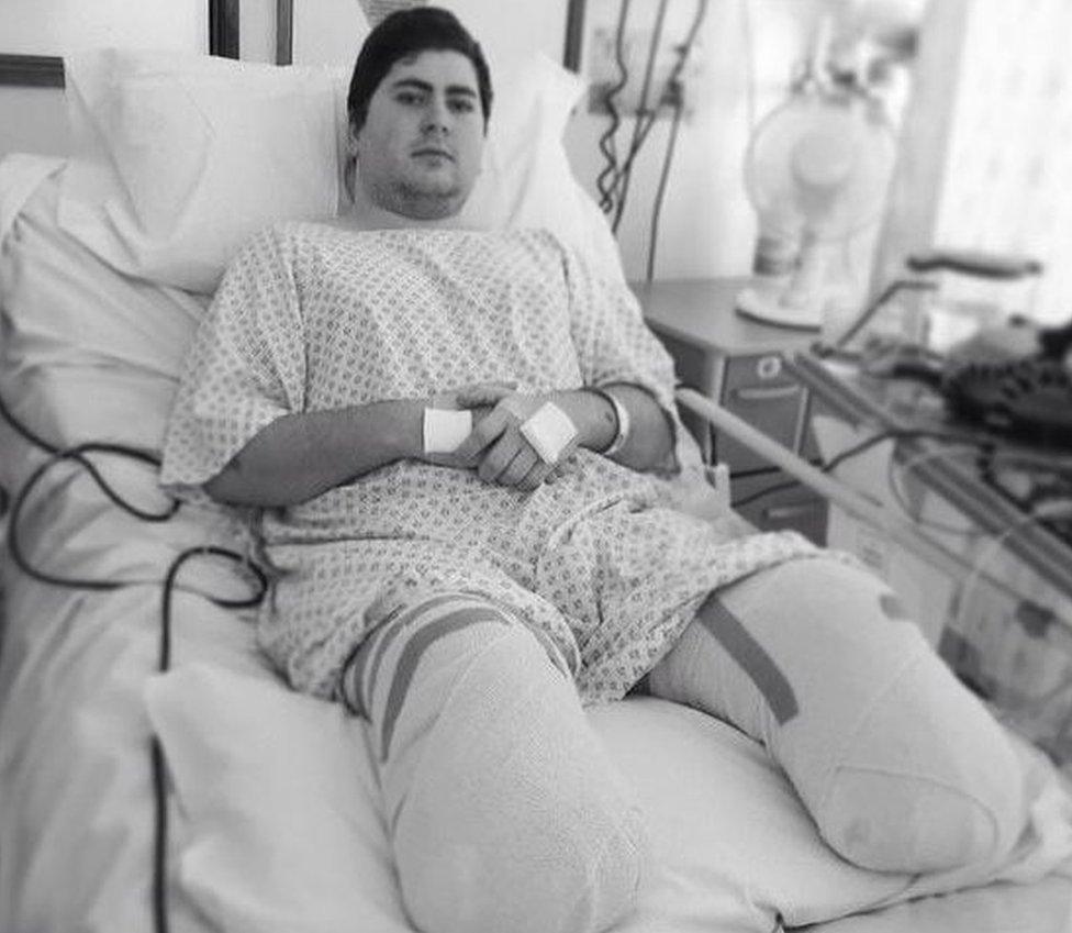 Jacob Gray: How I found myself disabled in an instant - BBC News