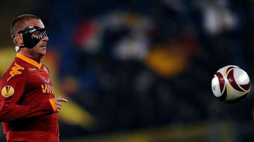 Kylian Mbappe: 11 iconic images of great players in masks - BBC Sport