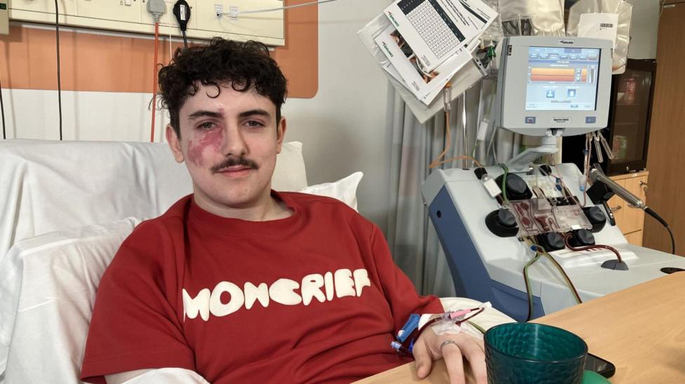 'We're giving transplant patients a second chance' - BBC News