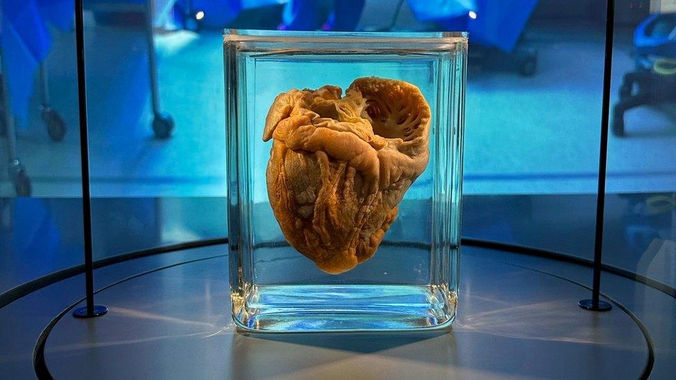 Transplant patient sees own heart go on display at museum - BBC News