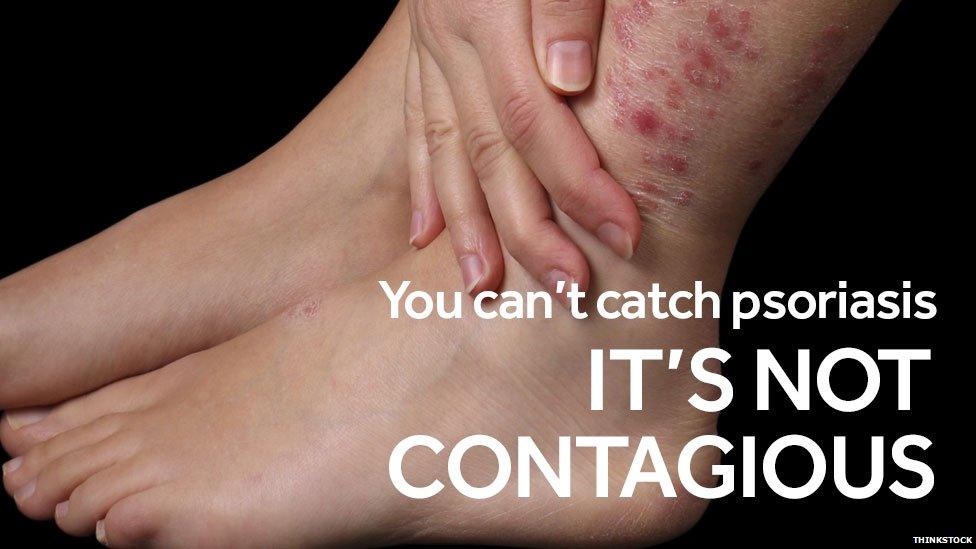 Facts psoriasis sufferers want to share with you - BBC News