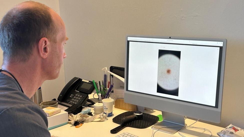 New app and lens trial 'cuts skin cancer referrals by 50%' - BBC News