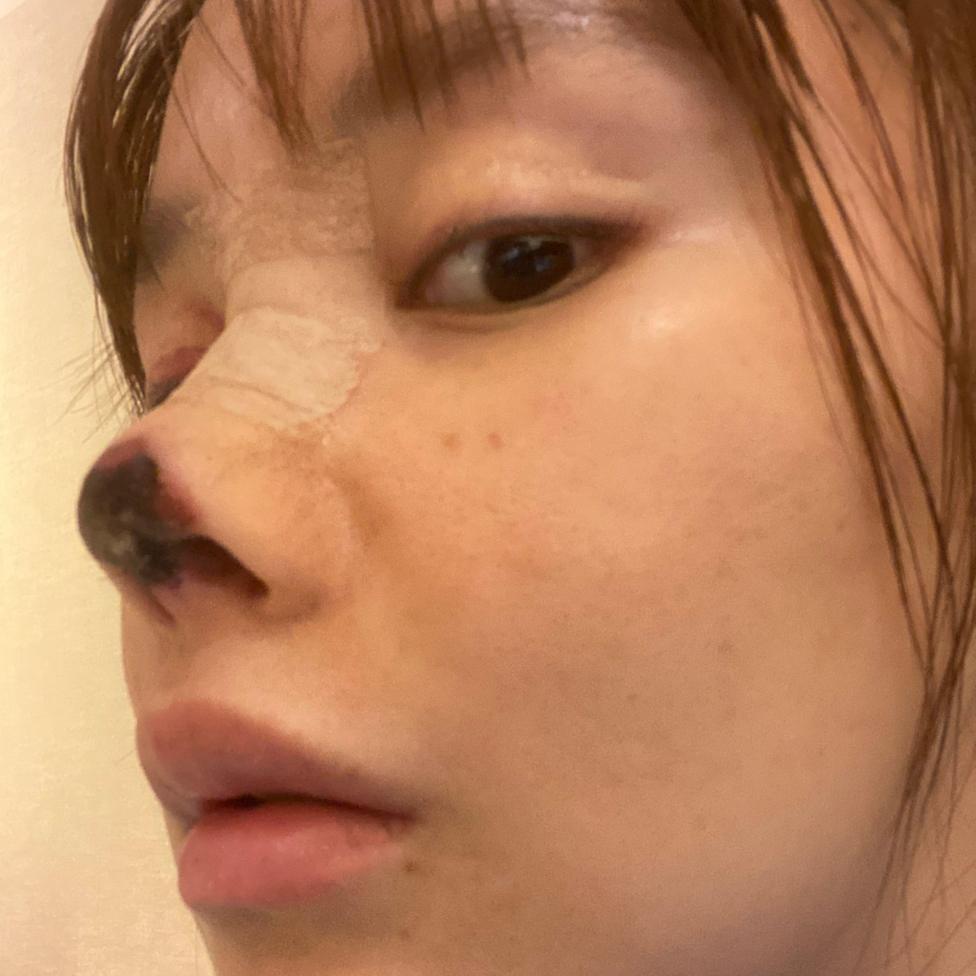 China's plastic surgery boom: 'I've had 100 operations and will never ...