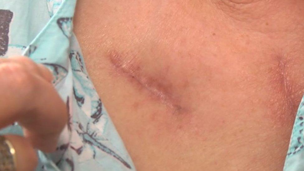 Inquiry starts over woman's pacemaker emergency - BBC News