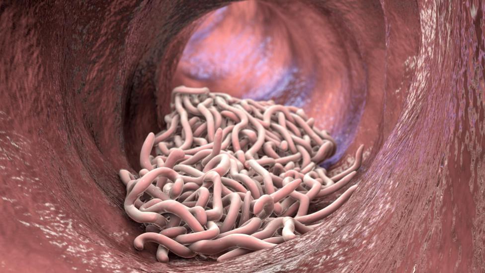 Could a mango flavoured pill end intestinal worms? - BBC News