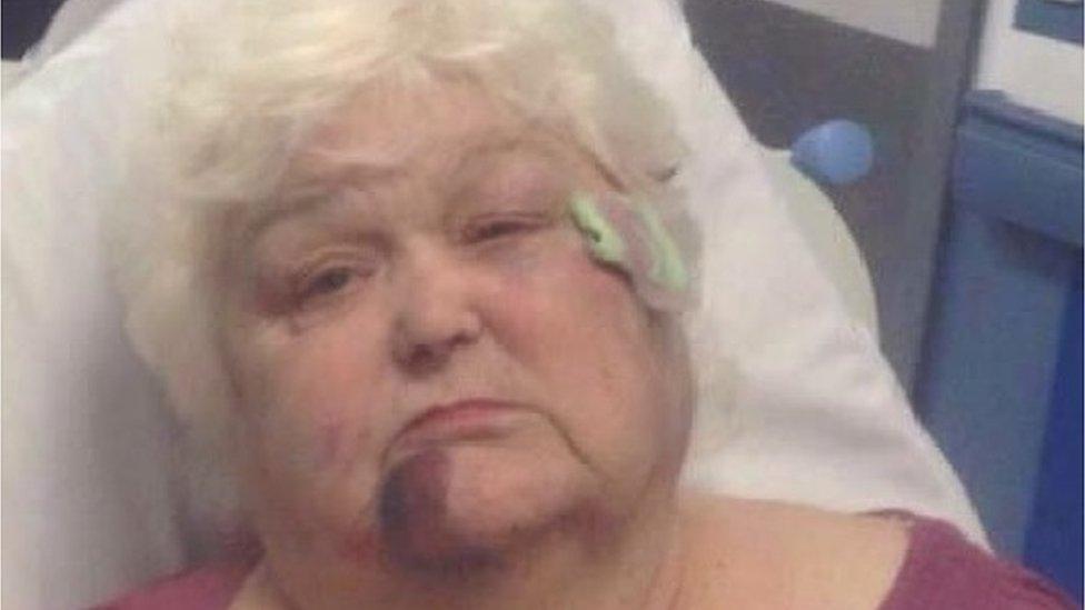 Rally held in west Belfast following attacks on elderly - BBC News