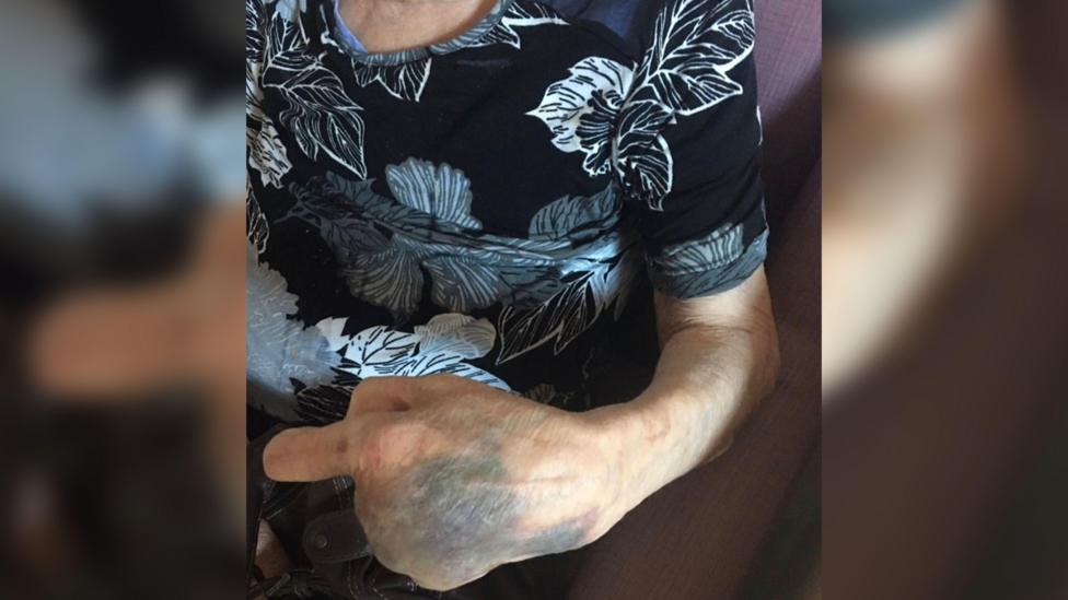 Runcorn care home accused of neglect by elderly resident's mother - BBC ...