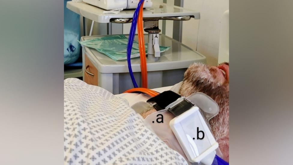 Brain cooling collar trial for Addenbrooke's head injury patients - BBC ...