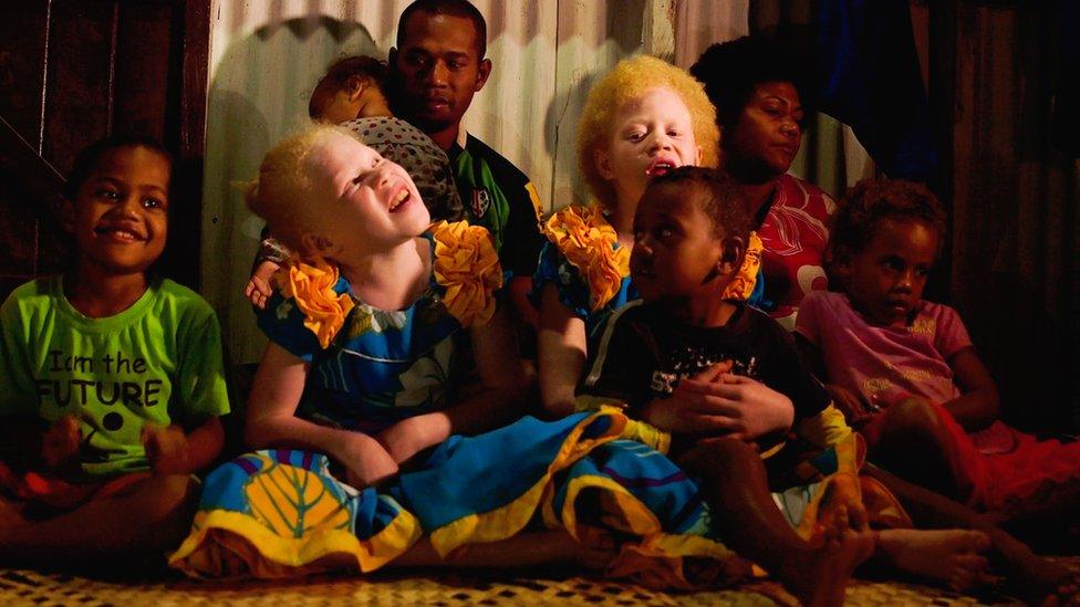 Film highlights Fiji's baffling rate of albinism - BBC News